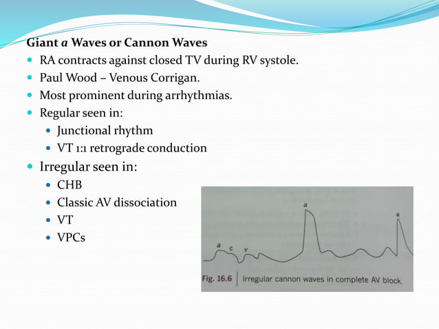 Jugular venous pressure | PPTX | Heart and Cardiovascular Diseases ...