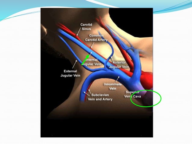 Jugular venous pressure | PPTX | Heart and Cardiovascular Diseases ...