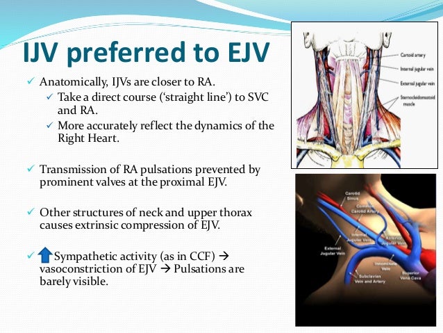 Jugular venous pressure