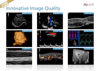 Ultrazvočni aparat Esaote MyLab40 eHD | PPT