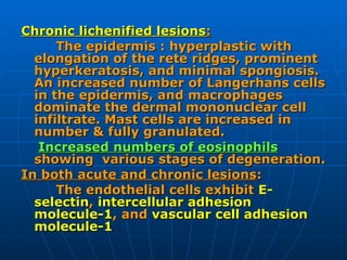 Atopic dermatitis | PPS