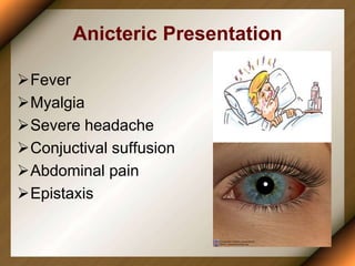 Leptospirosis | PPT