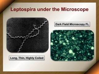 Leptospirosis | PPT