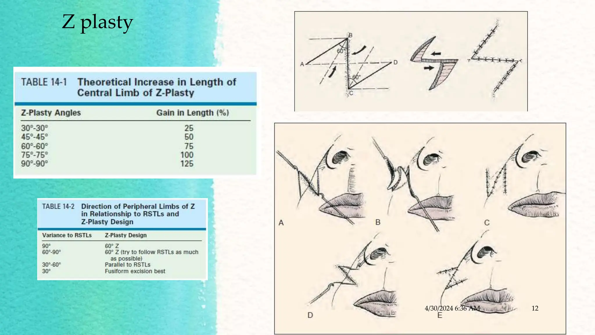 Local and regional flaps in head and neck.pptx