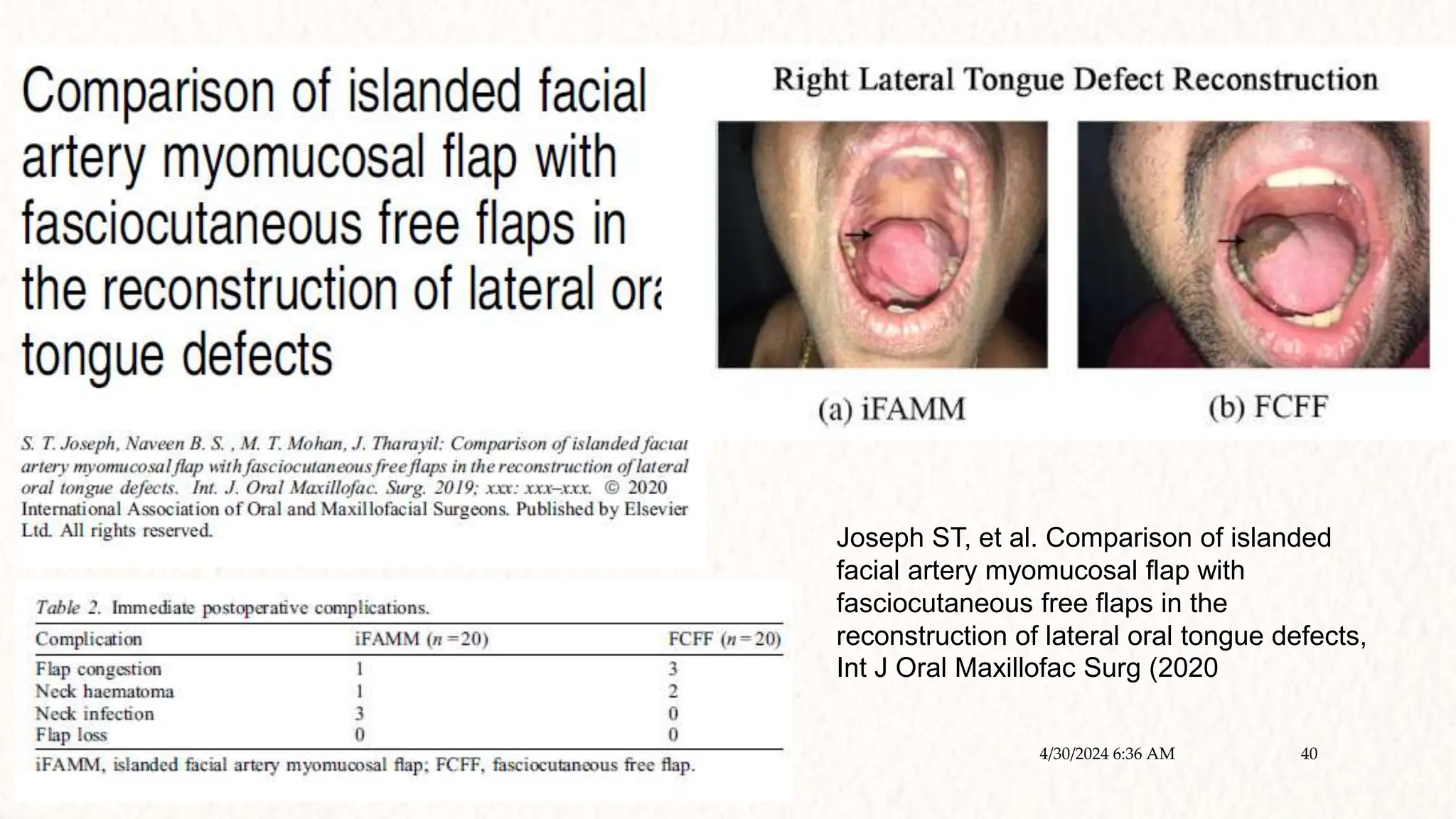 Local and regional flaps in head and neck.pptx