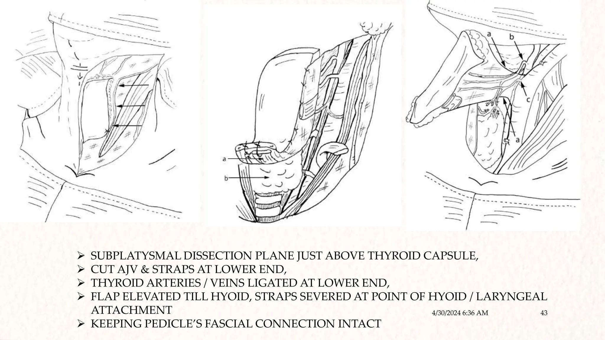 Local and regional flaps in head and neck.pptx