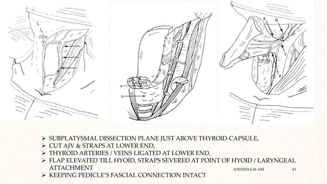 Local and regional flaps in head and neck.pptx
