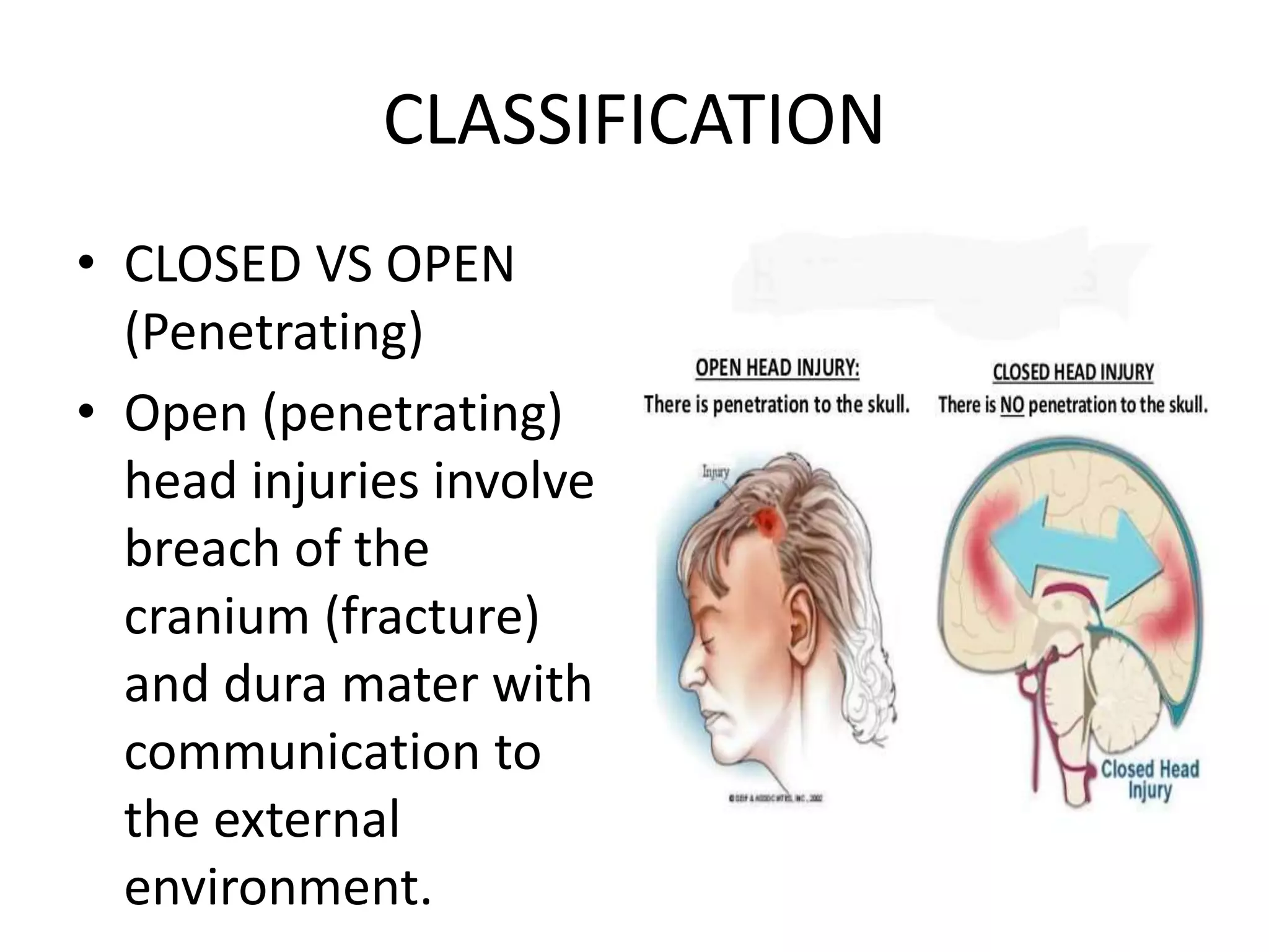 Management of head injury | PPTX