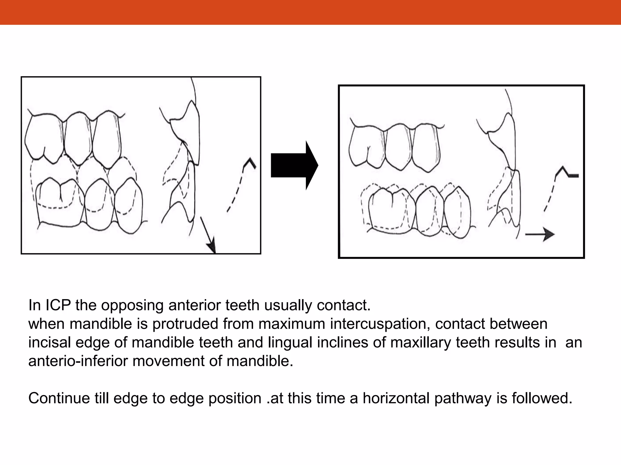 My mandibular movement final presentation | PPTX