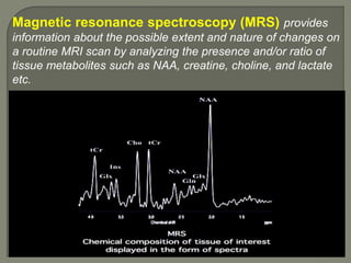 ROLE OF MRI AND MRS IN RING ENJANCING LESIONS OF BRAIN | PPTX