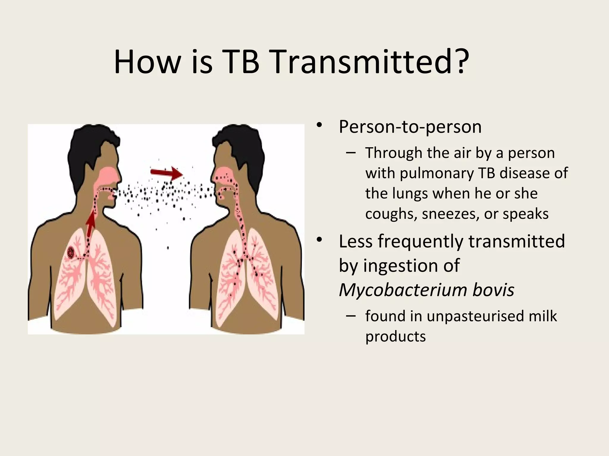 tuberculosis in children-Hamisi Mkindi | PPT