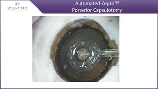 Ophthalmology Innovation Showcase 2 - Mynosys Cellular Devices | PPT