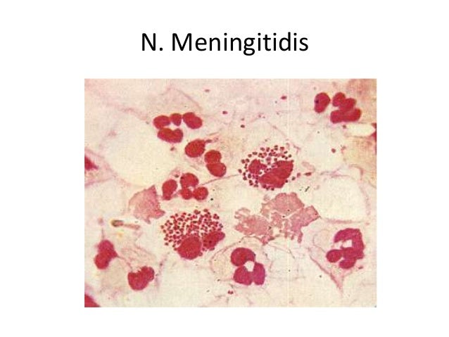 Gram staining, Culture , Antimicrobial sensitivity test