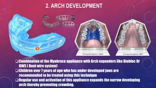 Myobrace system | PPTX