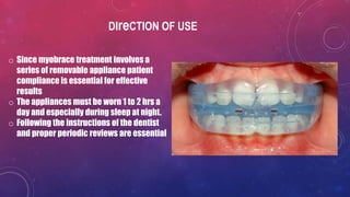 Myobrace system | PPTX