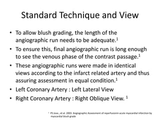 Myocardial Blush Coronary Artery Grading | PPTX