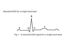 Myocardial Infarction Detection using ECG.pptx