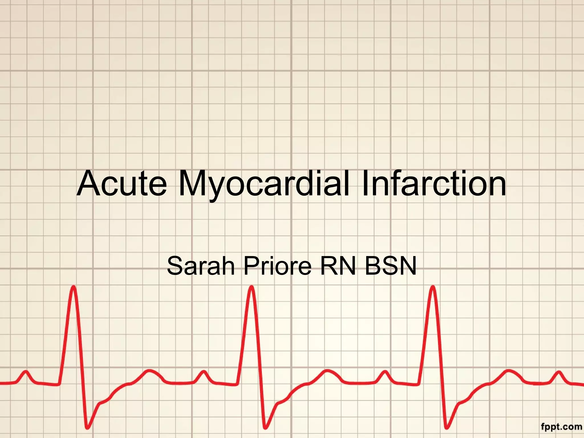 Myocardial infarction | PPT