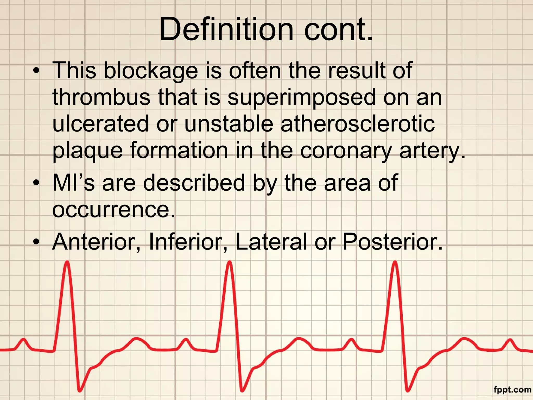 Myocardial infarction | PPT