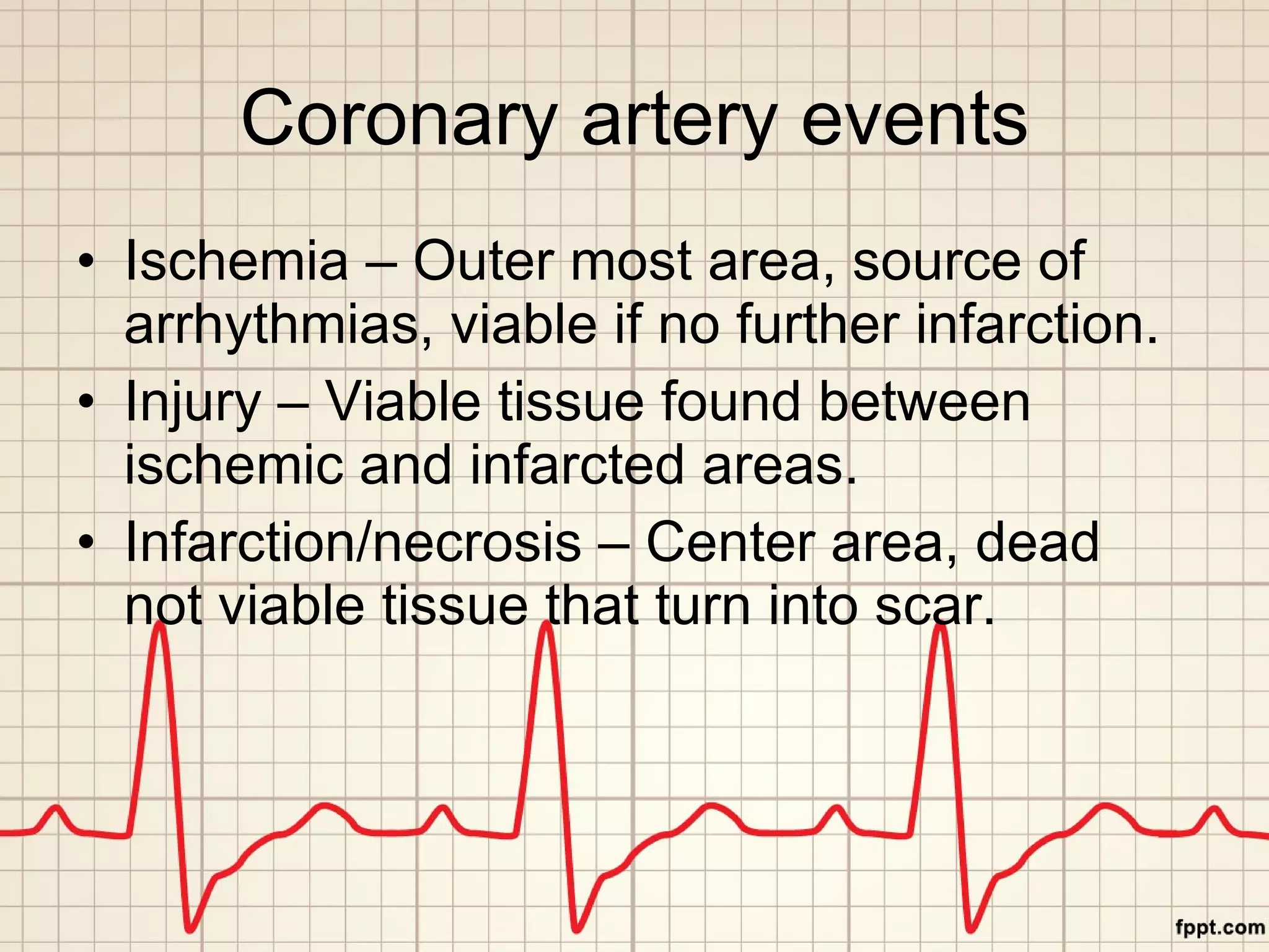 Myocardial infarction | PPT
