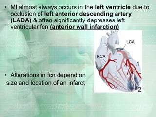 Myocardial Infarction | PPTX