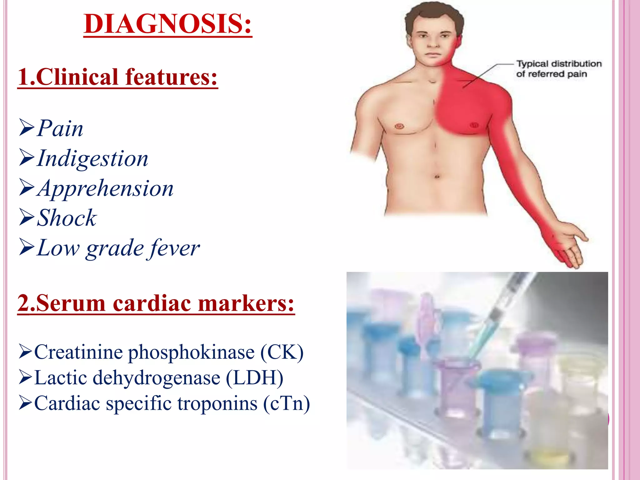 Myocardial infarction | PPTX