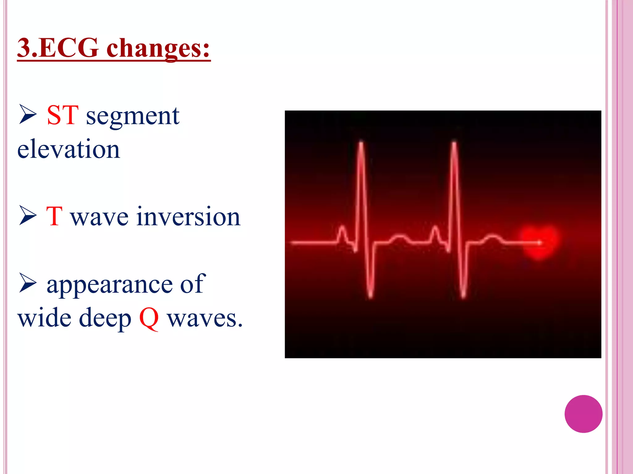 Myocardial infarction | PPTX