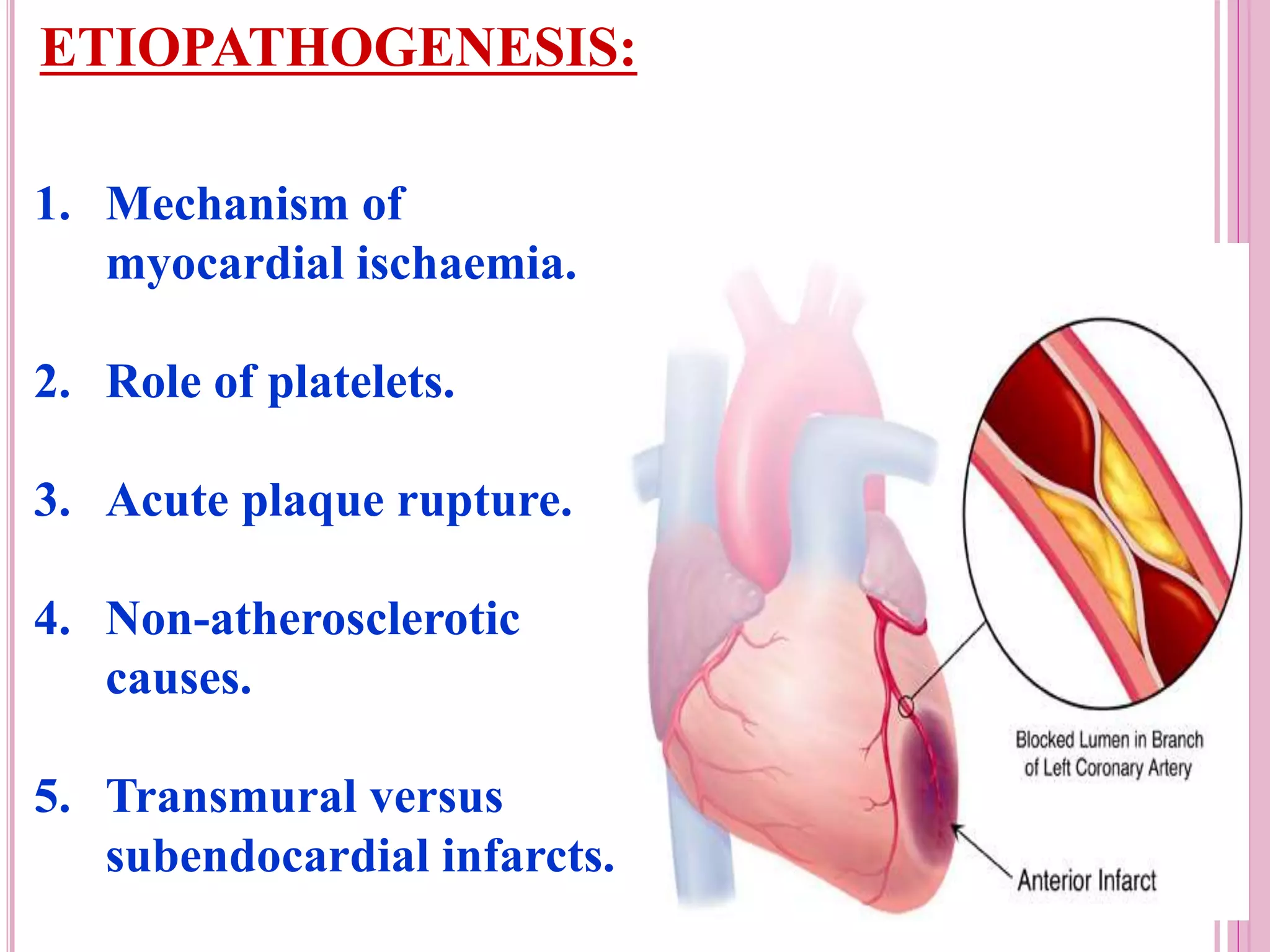 Myocardial infarction | PPTX