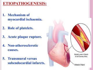 Myocardial infarction | PPTX
