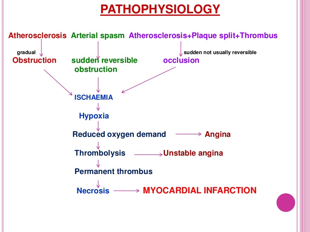 Myocardial infarction