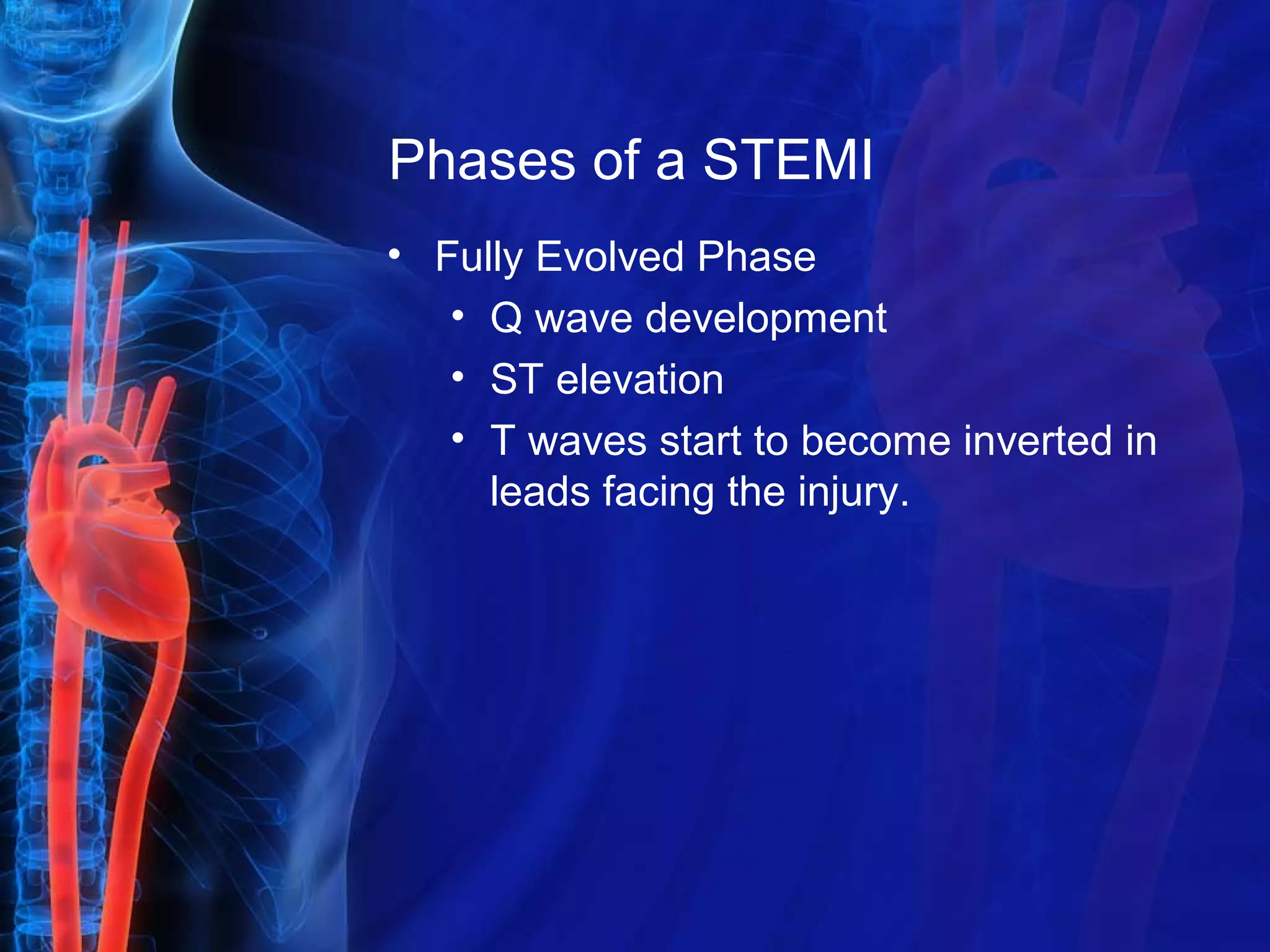 Myocardial infarction | PPT
