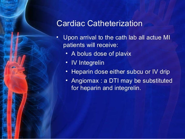 Myocardial infarction