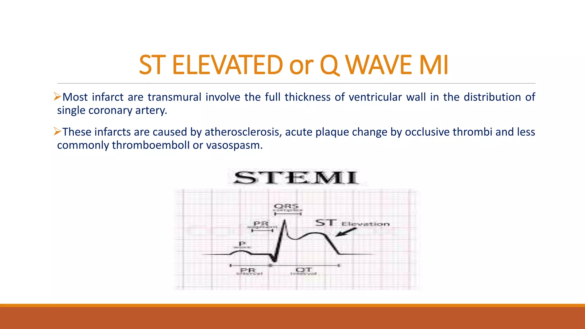 Myocardial infarction | PPTX