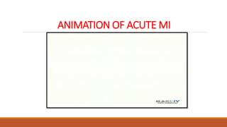 Myocardial infarction | PPT