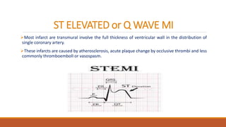 Myocardial infarction | PPT