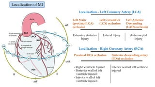 Myocardial infarction - Medicalbooksvn.wordpress.com