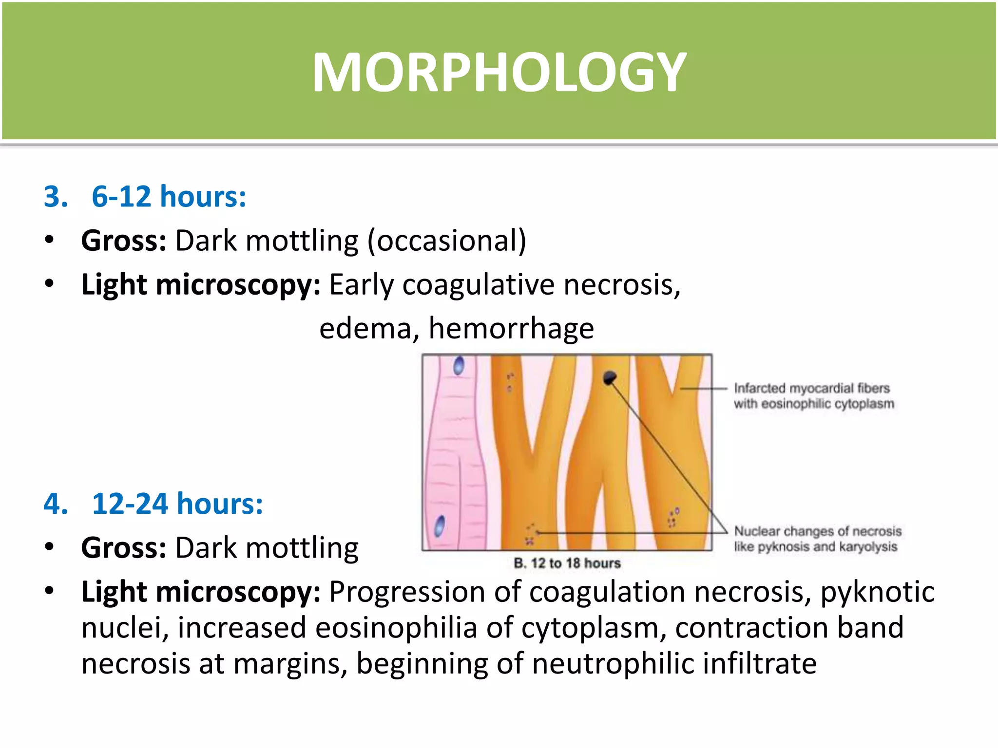 Pathogenesis And Morphological changes of Myocardial Infarction | PPTX