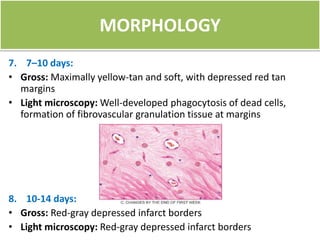 Pathogenesis And Morphological changes of Myocardial Infarction | PPTX