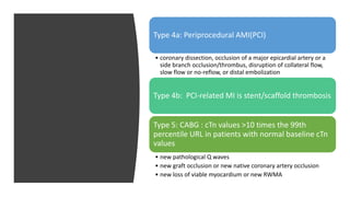 Myocardial infarction | PPTX
