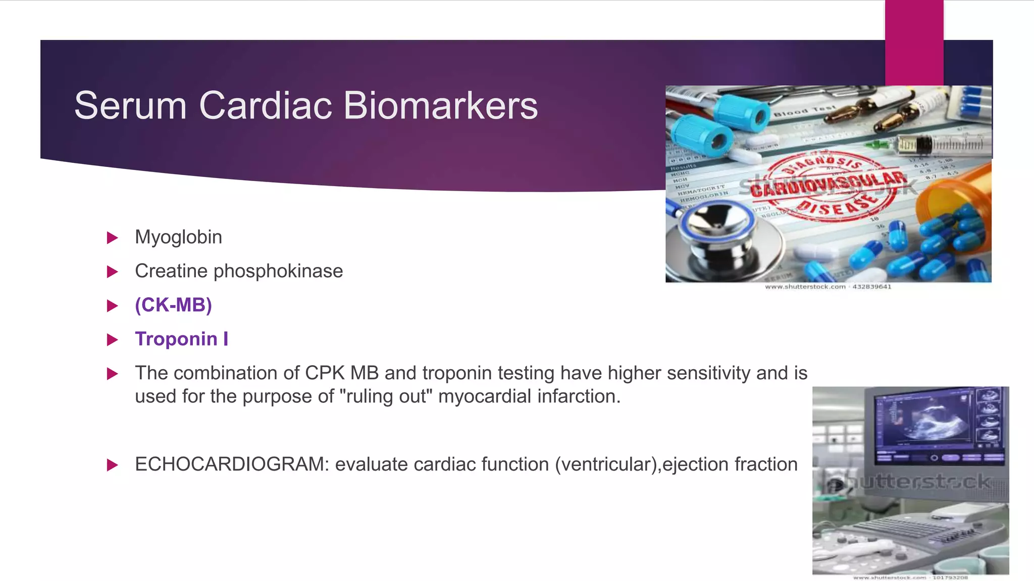 Myocardial infarction | PPTX