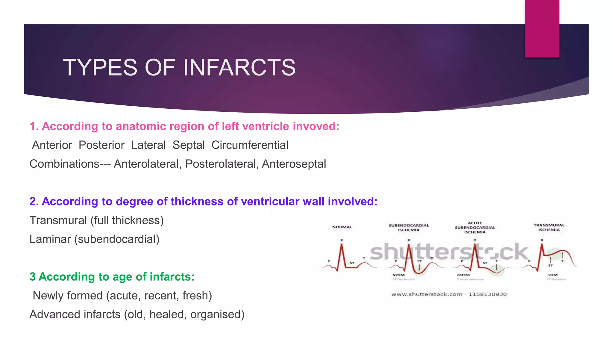 Myocardial infarction | PPTX