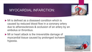 Myocardial infarction | PPTX