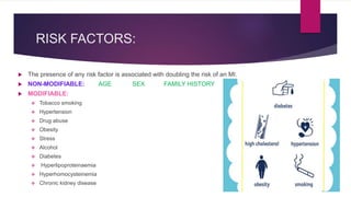 Myocardial infarction | PPTX