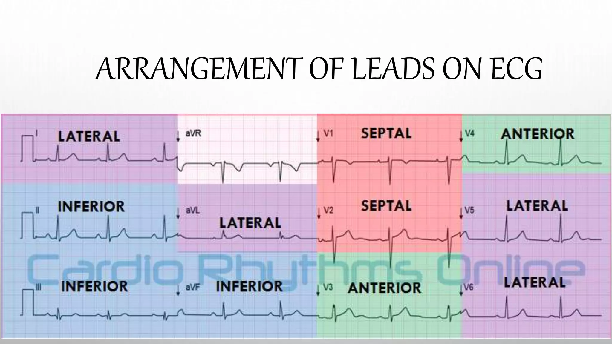 Myocardial infarction: introduction, clinical manifestation ...