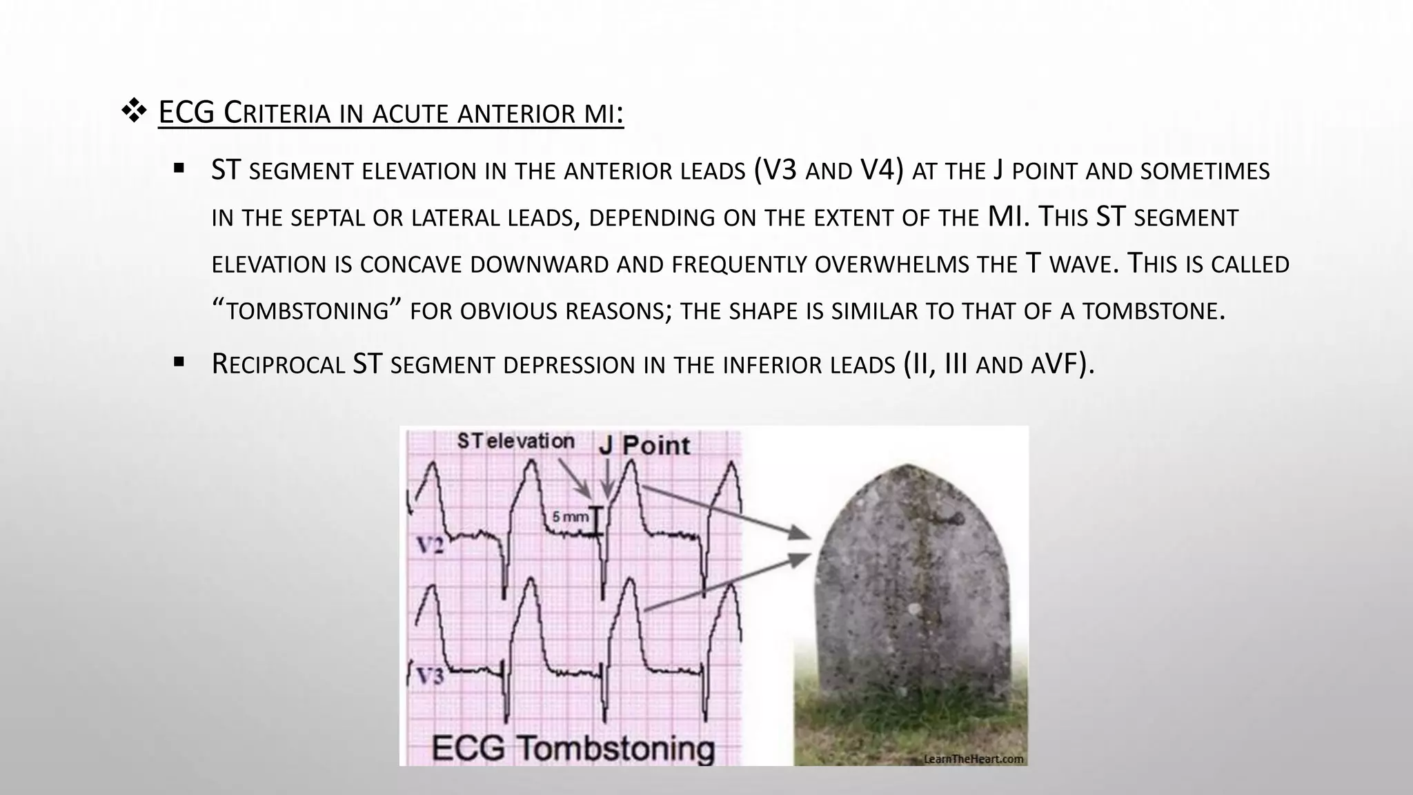 Myocardial infarction: introduction, clinical manifestation ...