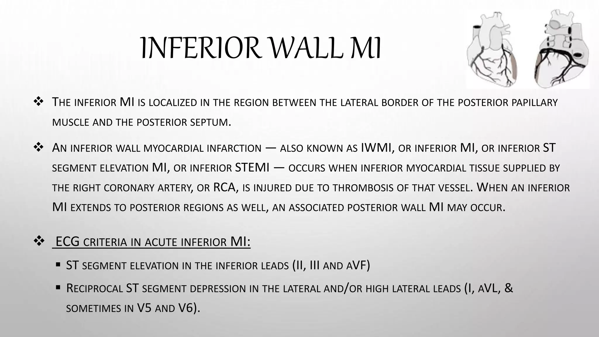 Myocardial infarction: introduction, clinical manifestation ...
