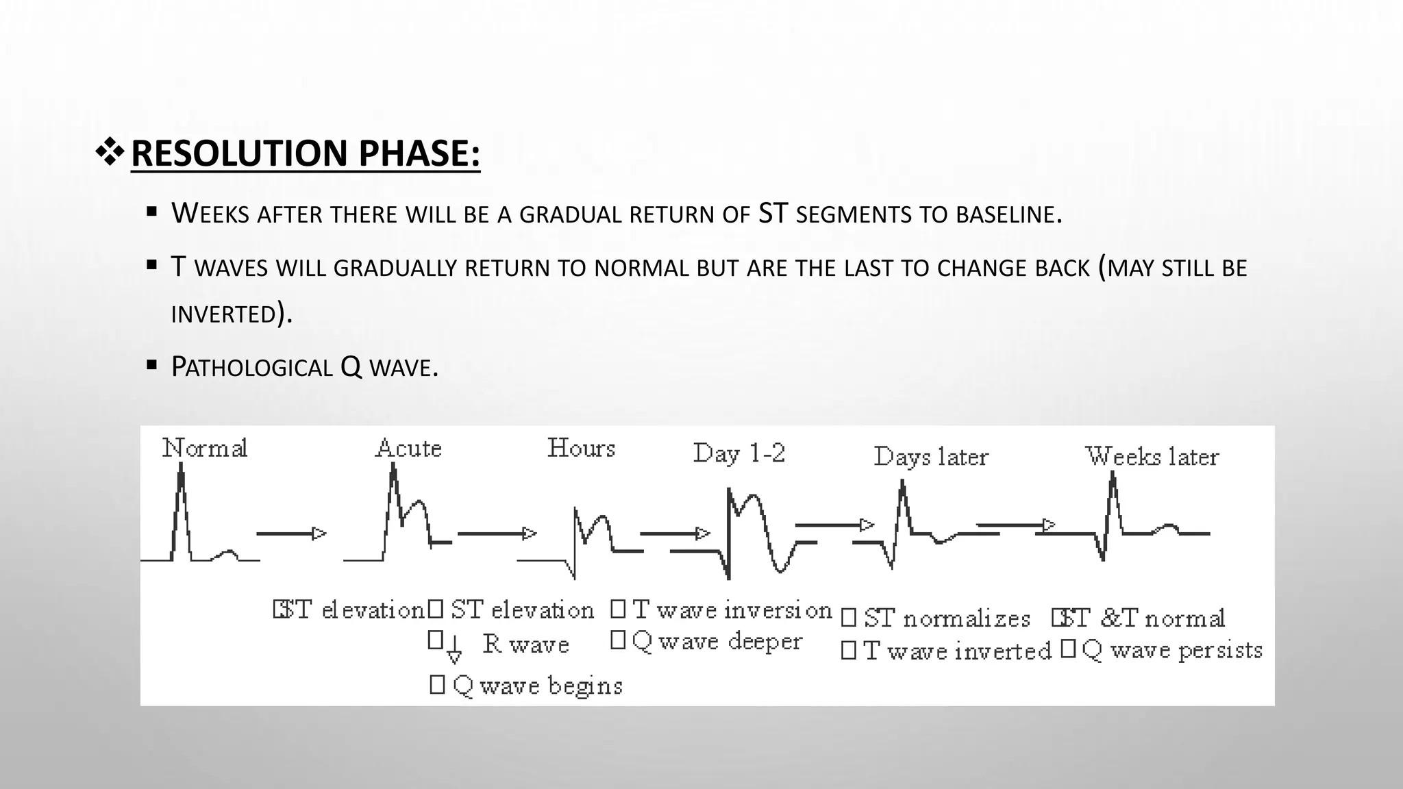 Myocardial Infarction Introduction Clinical Manifestation Classification Ecg Interpretation