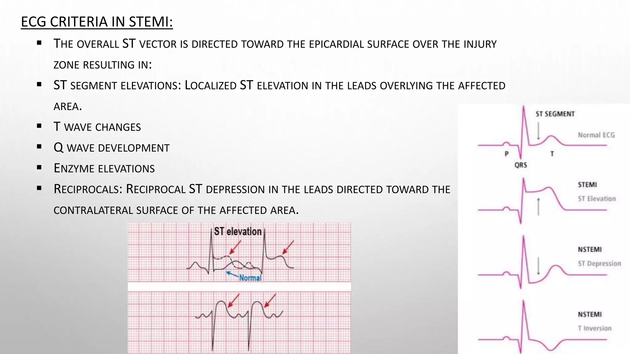 Myocardial infarction: introduction, clinical manifestation ...