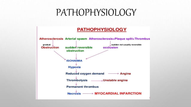 Myocardial infarction: introduction, clinical manifestation ...
