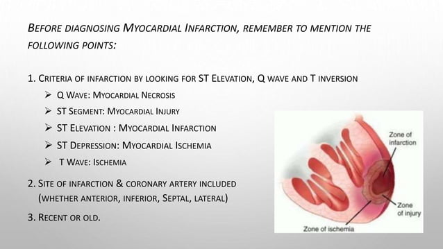 Myocardial infarction: introduction, clinical manifestation ...